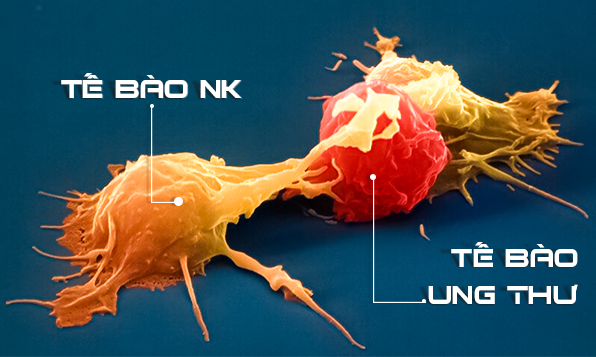 Tế Bào NK “Sát thủ tự nhiên” – Chiến Lược Điều Trị Ung Thư Tương Lai ...